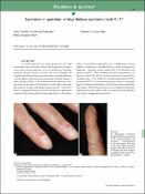 Syndrome in question: Antisynthetase syndrome (anti-PL-7)